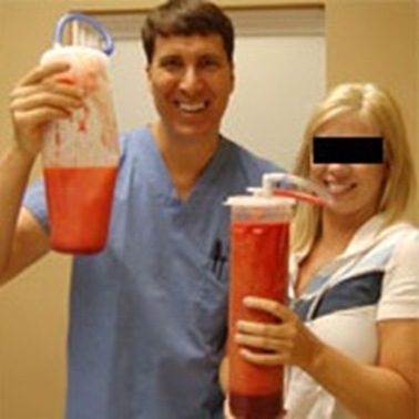 Bikini Model In The World: Craig Alan Bittner, "Lipo-Diesel" Doctor ...